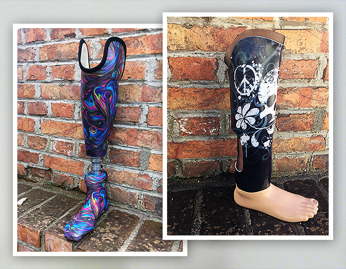 SEPIN Orthopädietechnik - Ihr Sanitätshaus in Klagenfurt, Villach ...